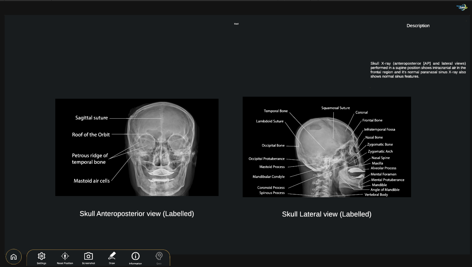 Anatomy | Learn in 3D with Cadaviz