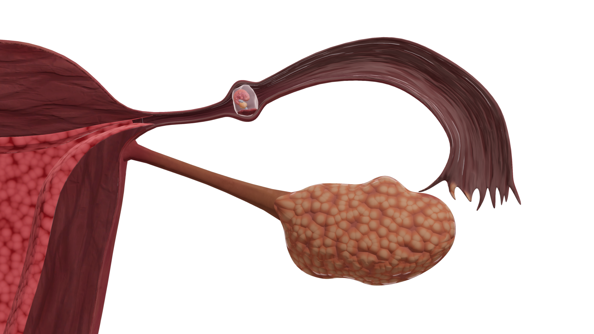 Ectopic Pregnancy: All Important Things You Need to Know